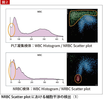 Talk CBC Vol.21 血球計数におけるNRBC測定（2） / ベックマン・コールター